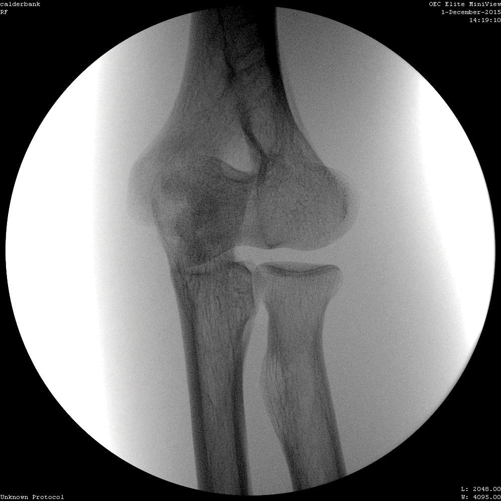 GE OEC Elite MiniView | Duomed