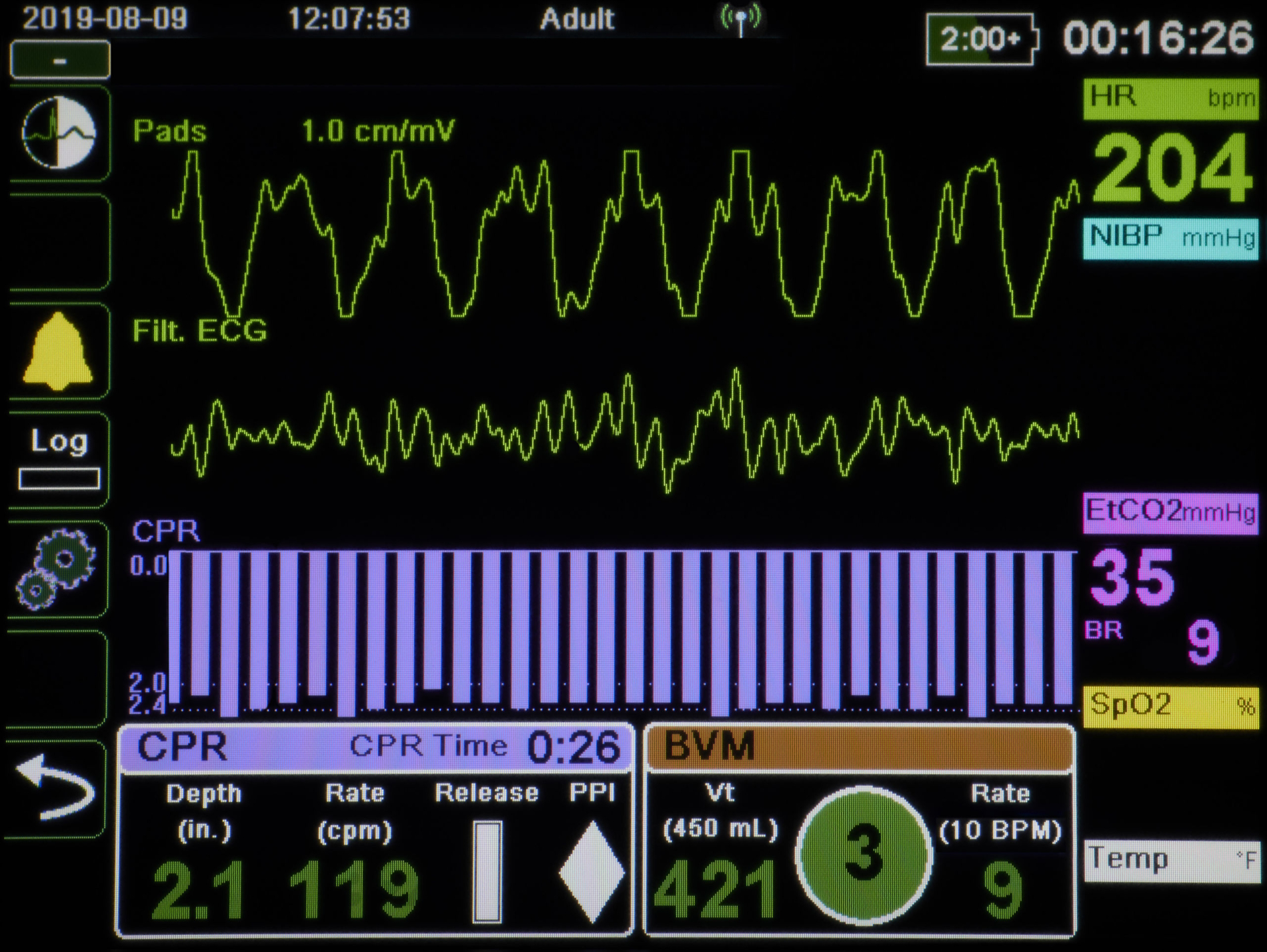 X Series® Advanced | Duomed