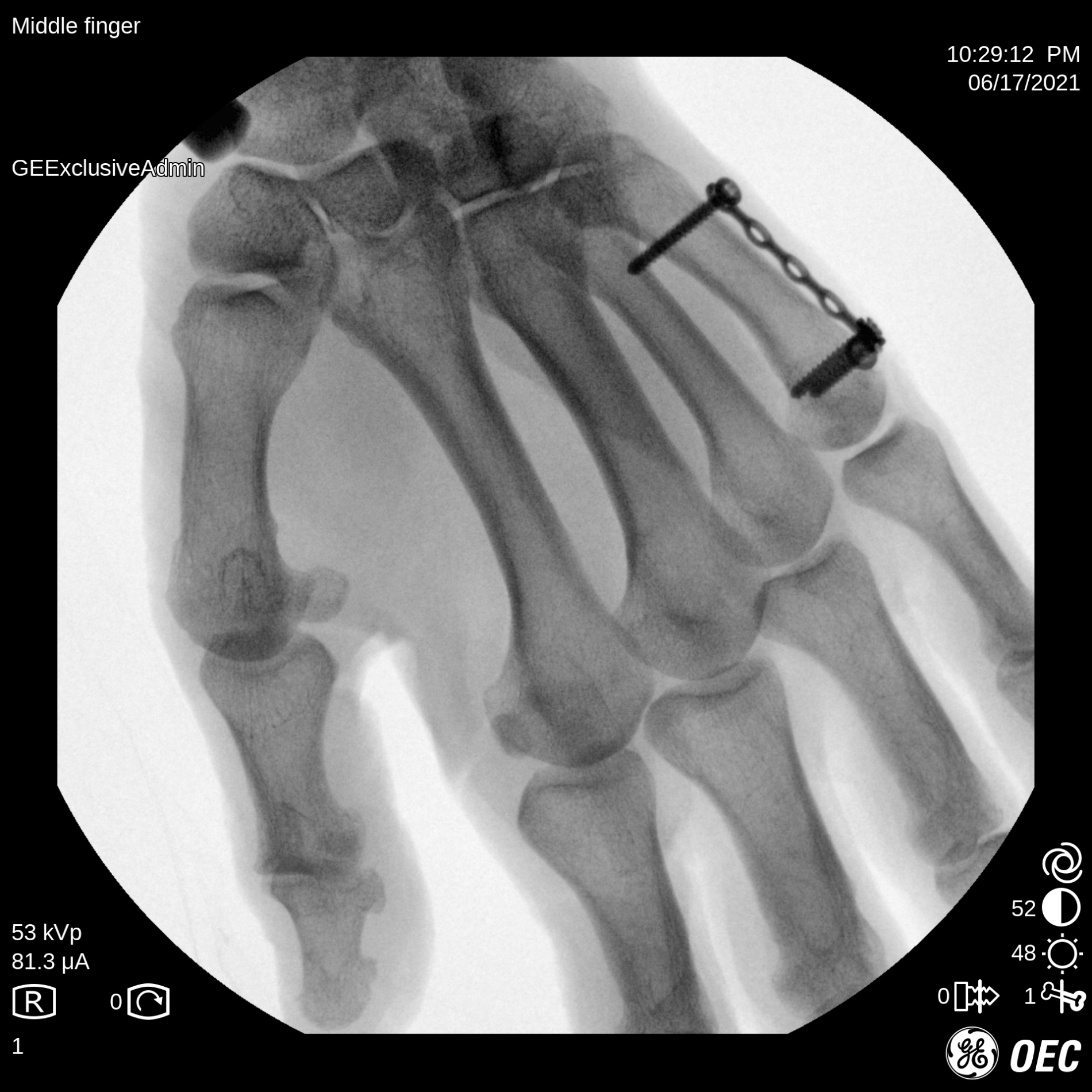 GE OEC Elite MiniView | Duomed