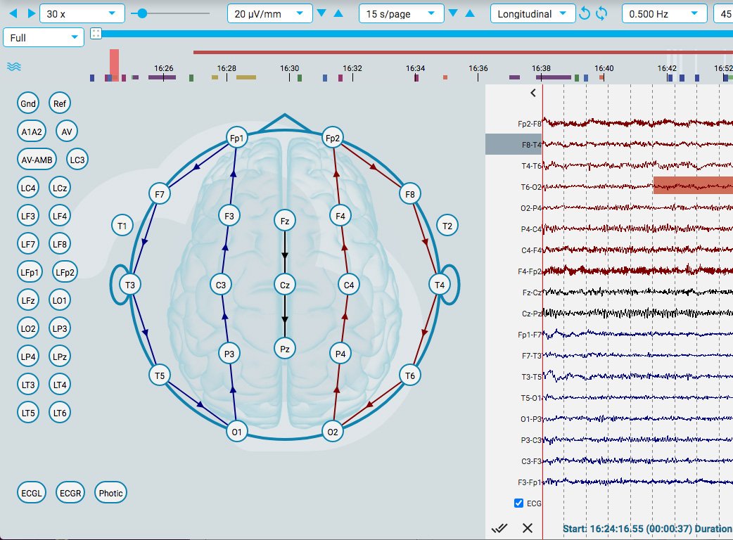 Stratus EEG | Duomed