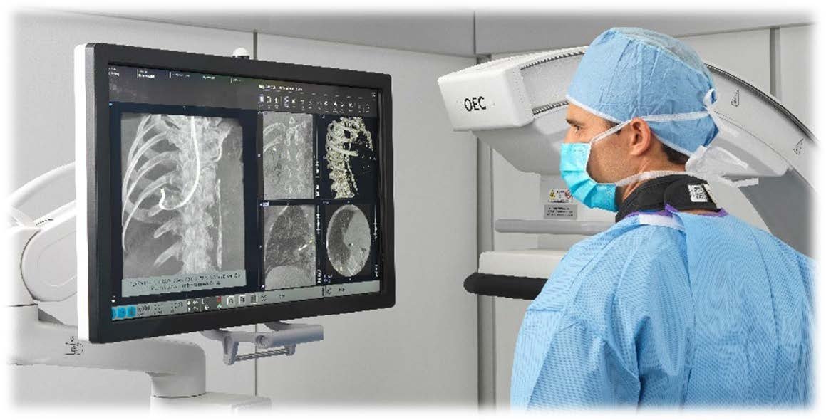 Real-time 3D imaging for bronchoscopy: OEC 3D Lung Suite | Duomed