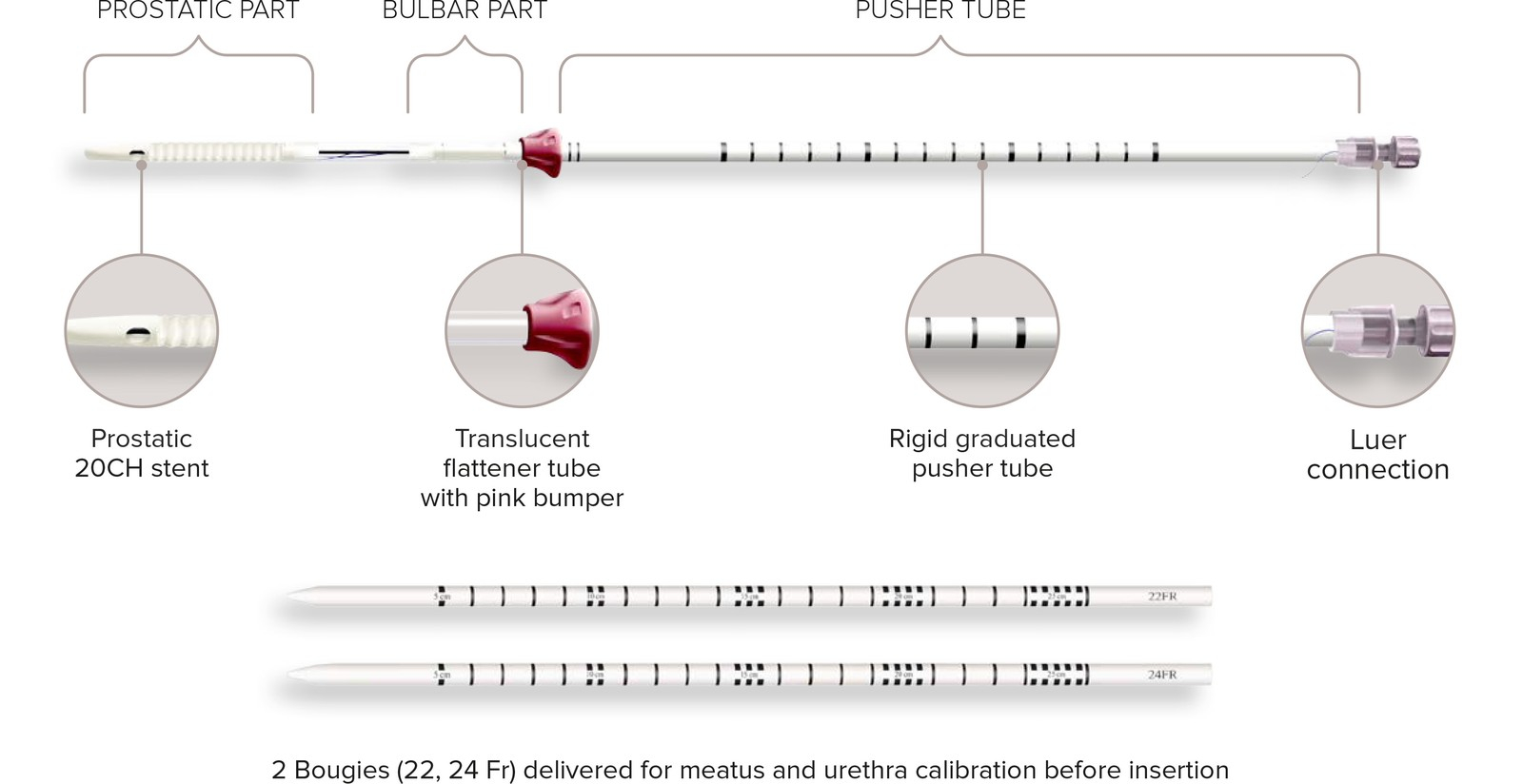 Temporary Prostatic Stent EXIME® | Duomed