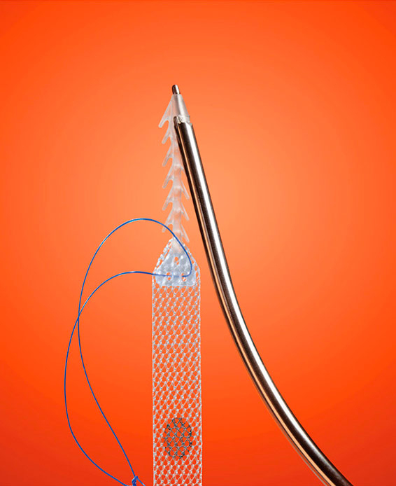 Minimal Invasive Stress Urinary Incontinence Treatment - Ophira | Duomed