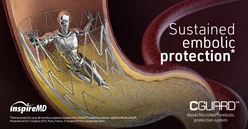 Stent for the prevention of carotid strokes: CGuard™ Embolic Prevention ...