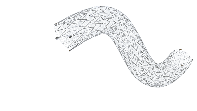 Stent for the prevention of carotid strokes: CGuard™ Embolic Prevention ...