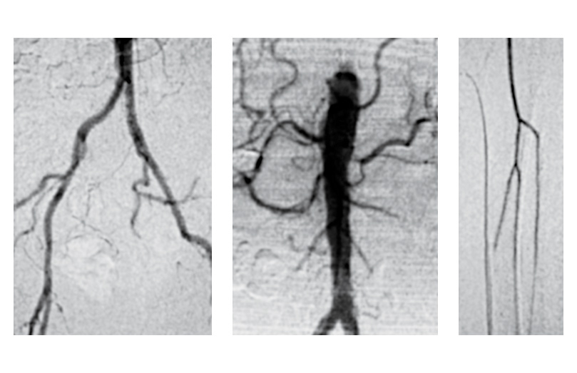 CO₂ Angioset | Duomed