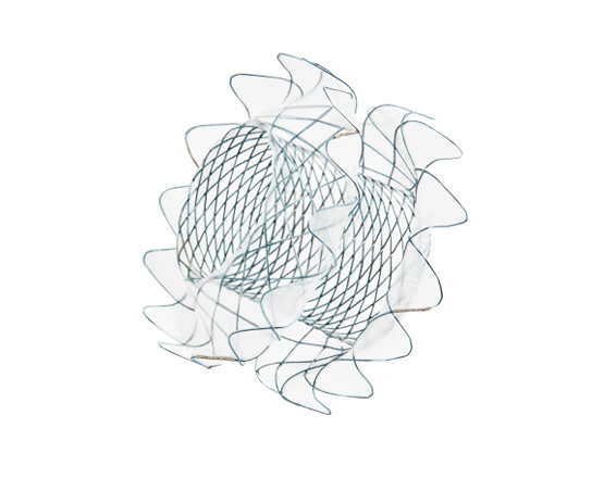 Niti-S™ SPAXUS™ Stent | Duomed