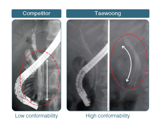 Niti-S™ D Biliary Stent | Duomed