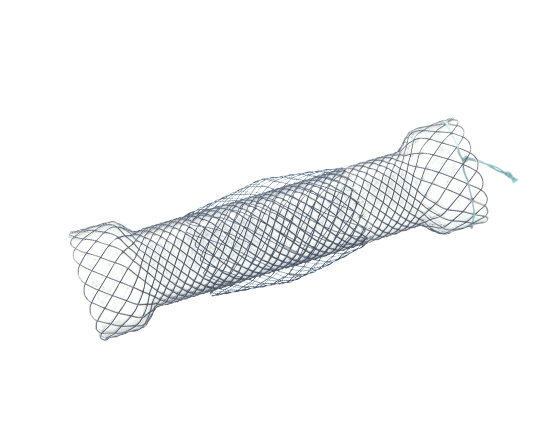 Niti-S™ DOUBLE™ Esophageal Stent | Duomed