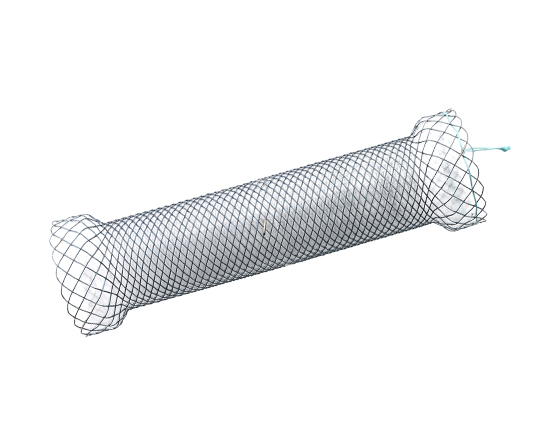 Niti-S™ S Enteral Colonic Stent | Duomed