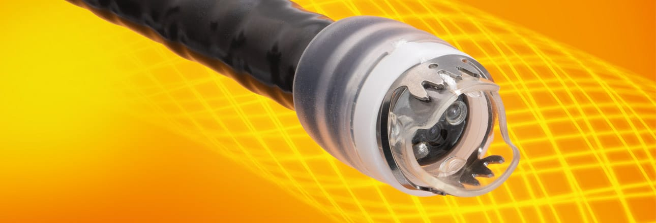 Stentfix OTSC® System | Duomed