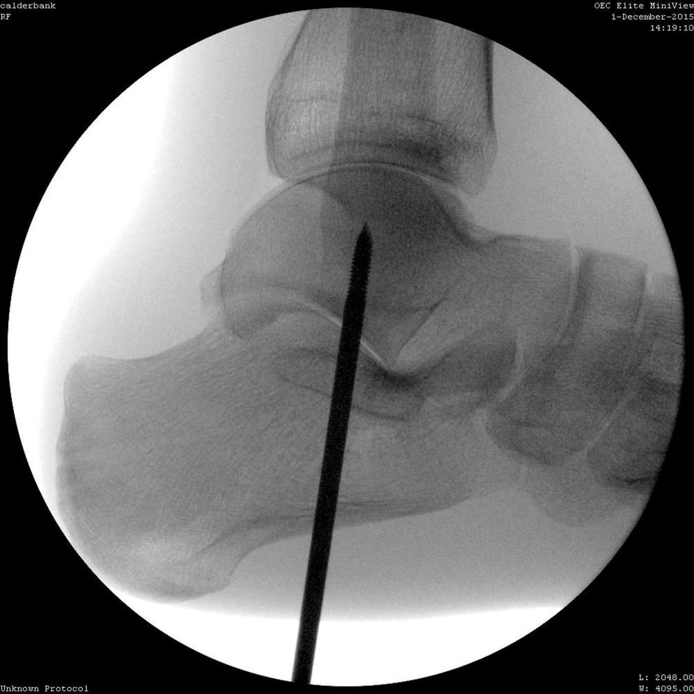 GE OEC Elite MiniView | Duomed