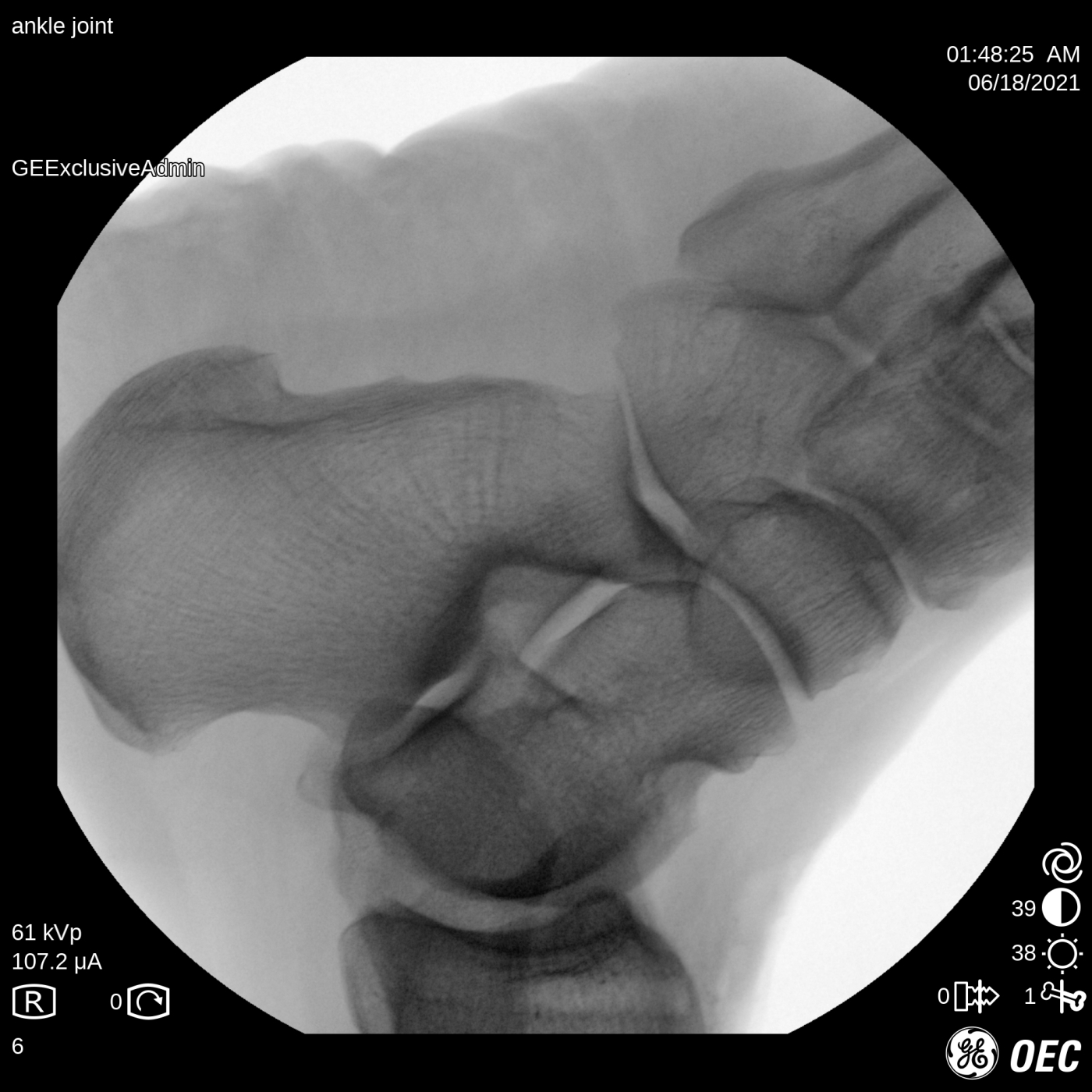 GE OEC Elite MiniView | Duomed