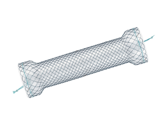 Niti-S™ Esophageal Covered Stent (Covered) | Duomed